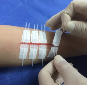 Dressings - Edge Medical